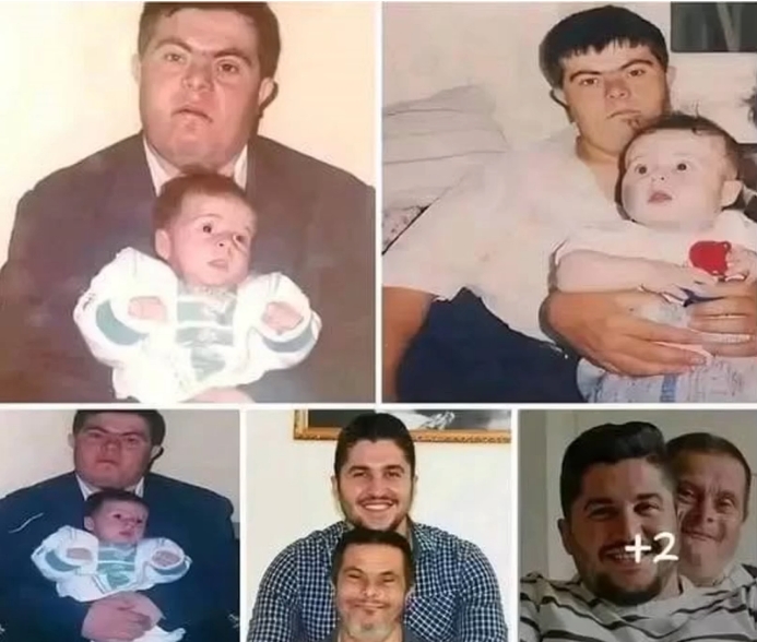 A father with Down syndrome raised his son, who is now a doctor ...
